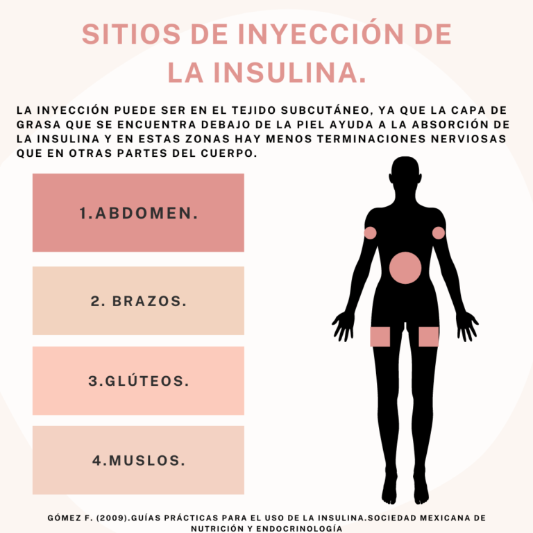 Sitio de inyección de la insulina – Alimentación y Salud Sitio de inyección de la insulina – Alimentación y Salud